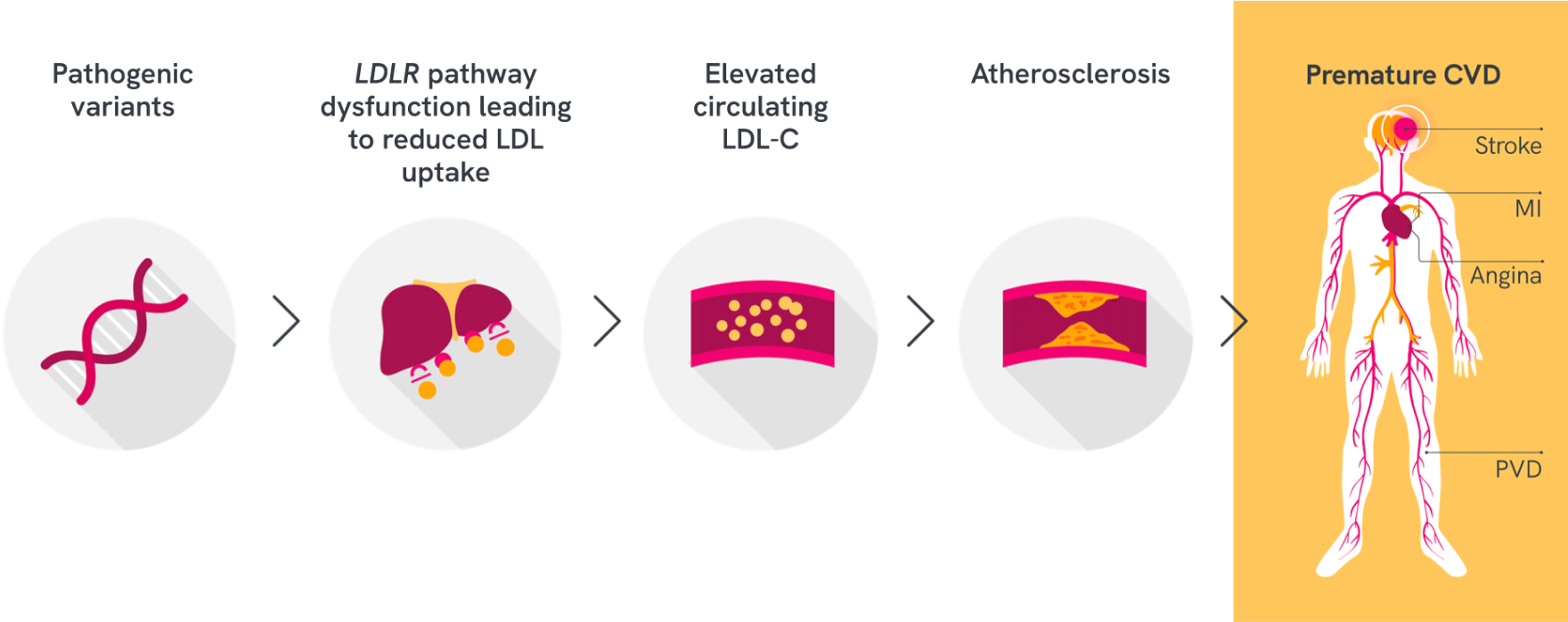 Pathogenesis - Homozygous Familial Hypercholesterolemia